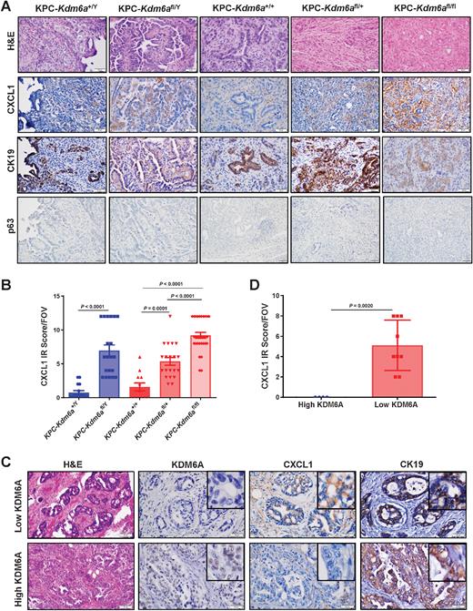 KDM6A Loss Recruits Tumor-Associated Neutrophils and Promotes ...