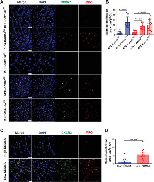 KDM6A Loss Recruits Tumor-Associated Neutrophils and Promotes ...
