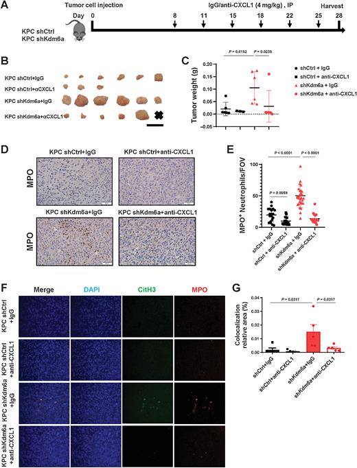 KDM6A Loss Recruits Tumor-Associated Neutrophils and Promotes ...