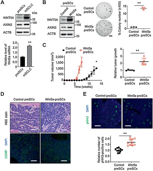 WNT5A–RHOA Signaling Is a Driver of Tumorigenesis and Represents a ...