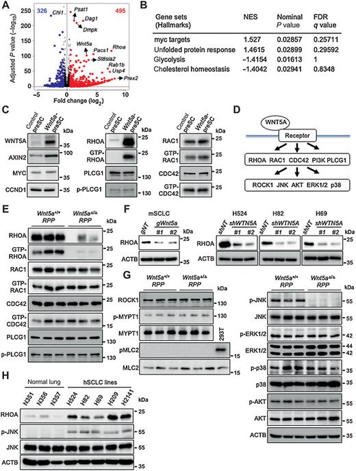 WNT5A–RHOA Signaling Is a Driver of Tumorigenesis and Represents a ...