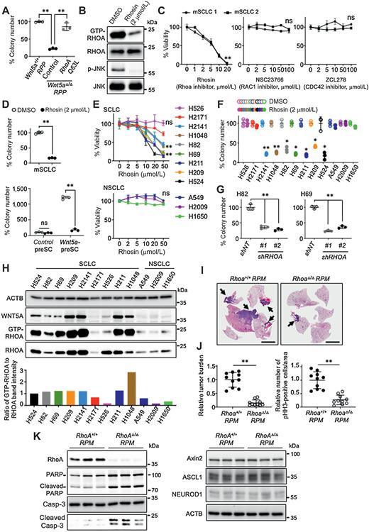 WNT5A–RHOA Signaling Is a Driver of Tumorigenesis and Represents a ...