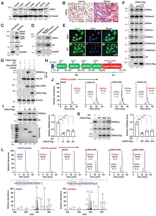 Loss of LOXL2 Promotes Uterine Hypertrophy and Tumor Progression by ...