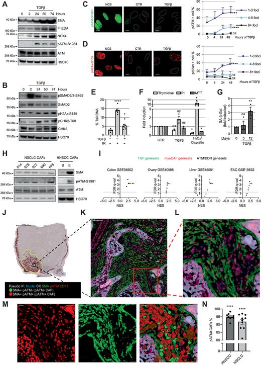 ATM Regulates Differentiation of Myofibroblastic Cancer-Associated ...