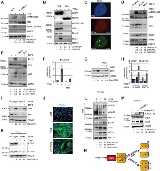 ATM Regulates Differentiation of Myofibroblastic Cancer-Associated ...