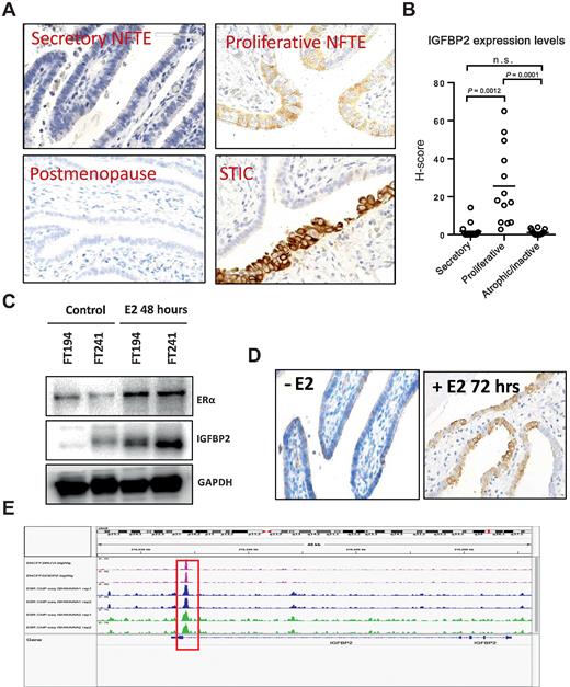 Spatial Transcriptomic Analysis of Ovarian Cancer Precursors Reveals ...