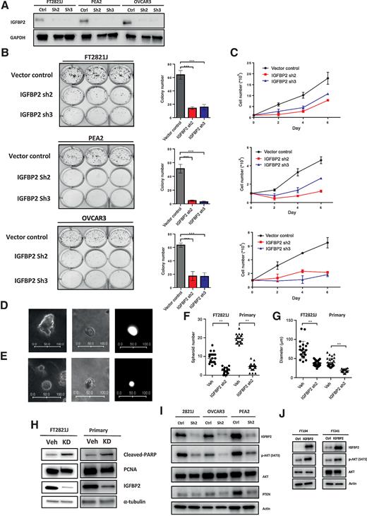 Spatial Transcriptomic Analysis of Ovarian Cancer Precursors Reveals ...