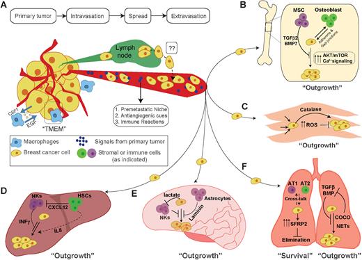 Breast Cancer Metastatic Dormancy and Relapse: An Enigma of ...