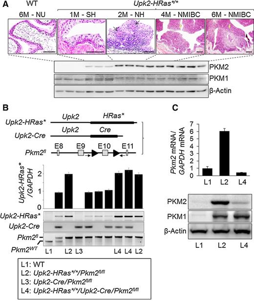 PKM2 Is Essential for Bladder Cancer Growth and Maintenance | Cancer ...