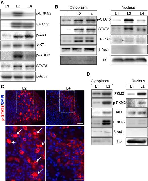 PKM2 Is Essential for Bladder Cancer Growth and Maintenance | Cancer ...
