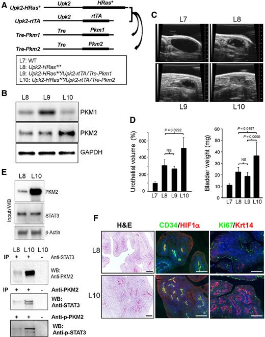 PKM2 Is Essential for Bladder Cancer Growth and Maintenance | Cancer ...