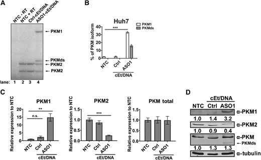 ASO-Based PKM Splice-Switching Therapy Inhibits Hepatocellular ...