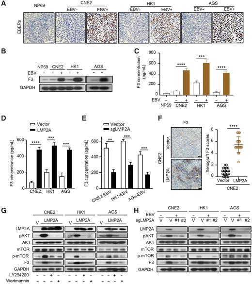 EBV Infection in Epithelial Malignancies Induces Resistance to ...