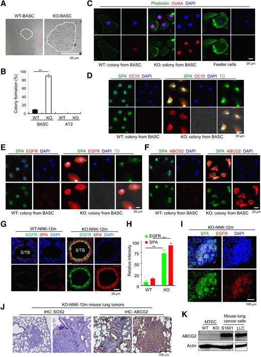 Identification of Active Bronchioalveolar Stem Cells as the Cell of ...