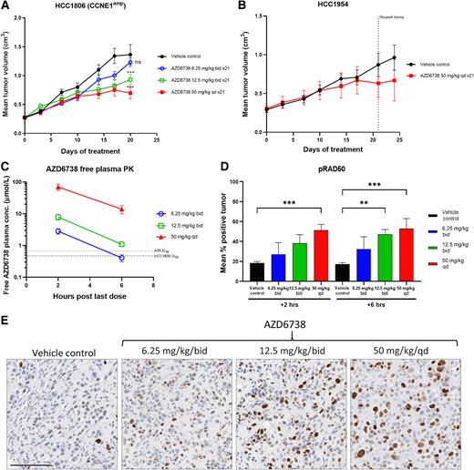 ATR Inhibitor AZD6738 (Ceralasertib) Exerts Antitumor Activity as a ...