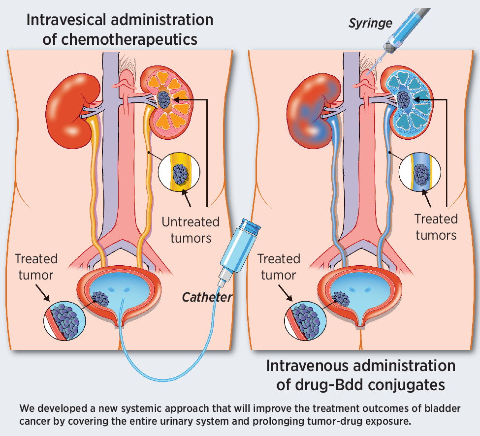 A Urinary Drug-Disposing Approach as an Alternative to Intravesical ...