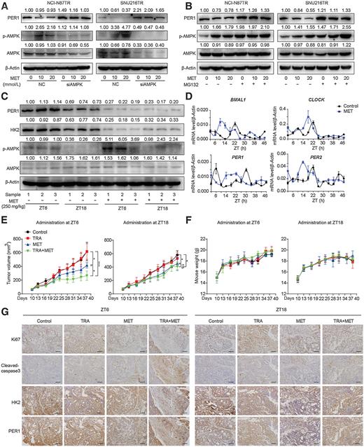 Disrupting Circadian Rhythm via the PER1–HK2 Axis Reverses Trastuzumab ...