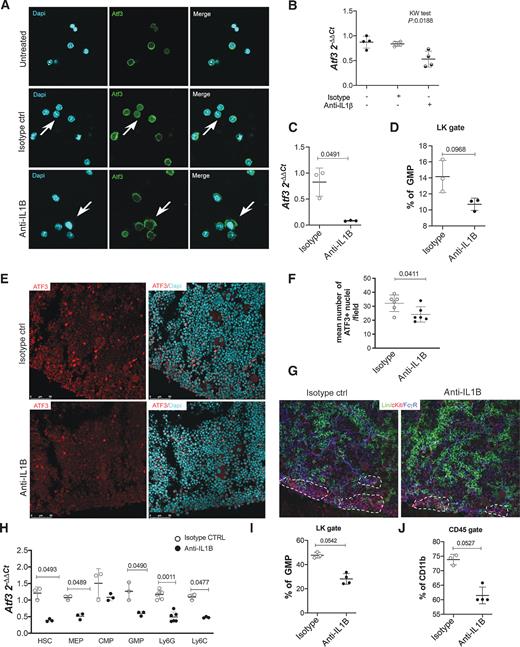 ATF3 Reprograms the Bone Marrow Niche in Response to Early Breast ...