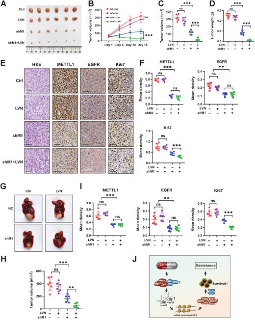 METTL1-Mediated m7G tRNA Modification Promotes Lenvatinib Resistance in ...