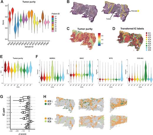 Spatial Transcriptomic Analysis of a Diverse Patient Cohort Reveals a Conserved Architecture in ...