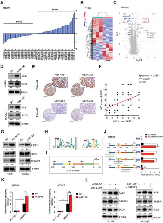 ASS1-Mediated Reductive Carboxylation of Cytosolic Glutamine Confers ...