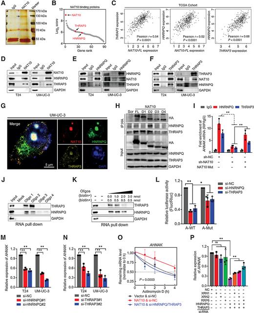 NAT10 Drives Cisplatin Chemoresistance by Enhancing ac4C-Associated DNA ...