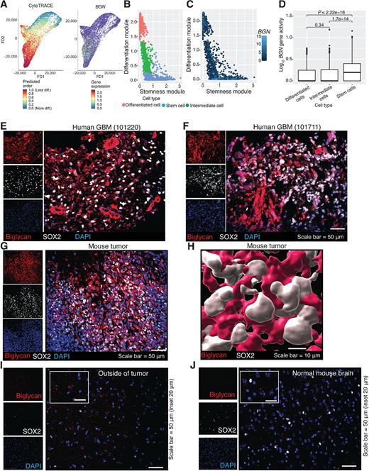 Single-Cell Spatial Analysis Identifies Regulators of Brain Tumor ...
