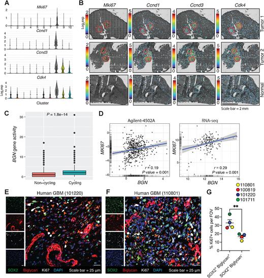 Single-Cell Spatial Analysis Identifies Regulators of Brain Tumor ...