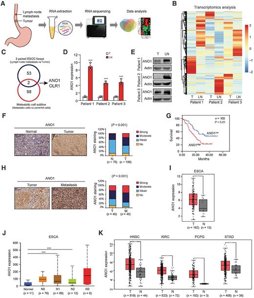 ANO1 Reprograms Cholesterol Metabolism and the Tumor Microenvironment ...