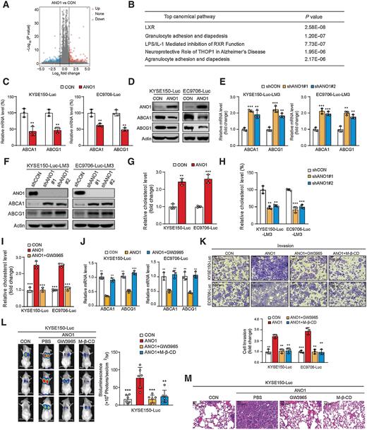 ANO1 Reprograms Cholesterol Metabolism and the Tumor Microenvironment ...