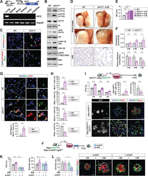 Dual Impact of IGF2 on Alveolar Stem Cell Function during Tobacco ...