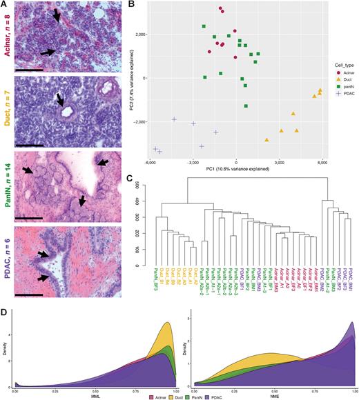 Comprehensive DNA Methylation Analysis Indicates That Pancreatic ...