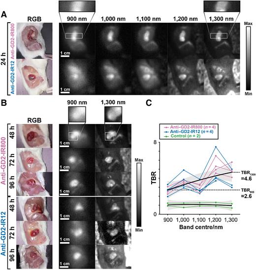 Shortwave Infrared Imaging Enables High-Contrast Fluorescence-Guided ...