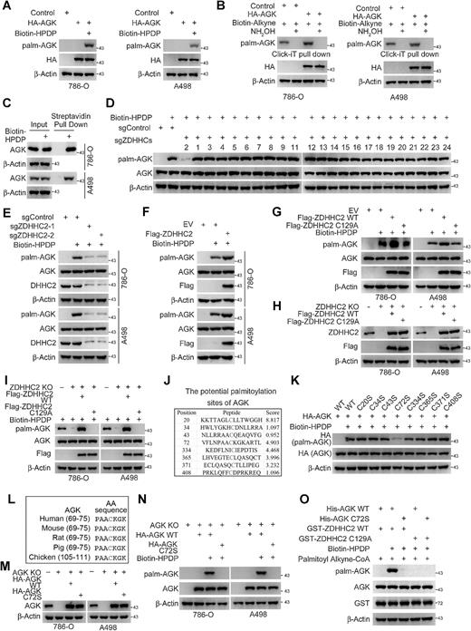ZDHHC2-Mediated AGK Palmitoylation Activates AKT–mTOR Signaling to ...