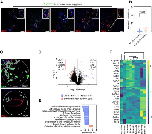 Periostin+ Stromal Cells Guide Lymphovascular Invasion by Cancer Cells ...
