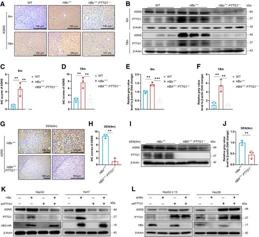 PTTG1 Reprograms Asparagine Metabolism to Promote Hepatocellular ...