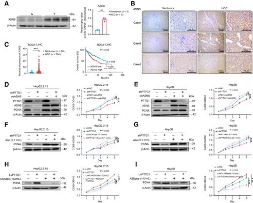 PTTG1 Reprograms Asparagine Metabolism to Promote Hepatocellular ...