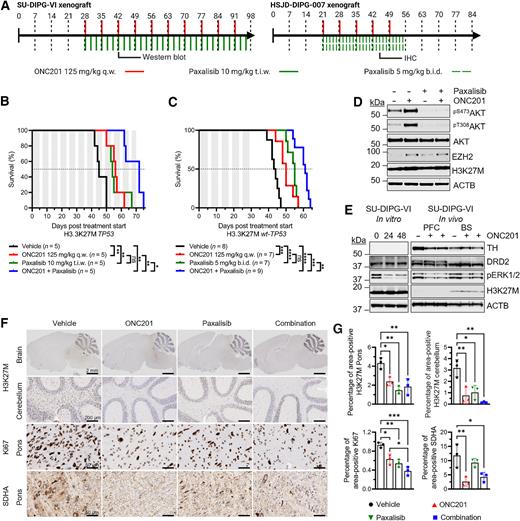 ONC201 in Combination with Paxalisib for the Treatment of H3K27-Altered ...
