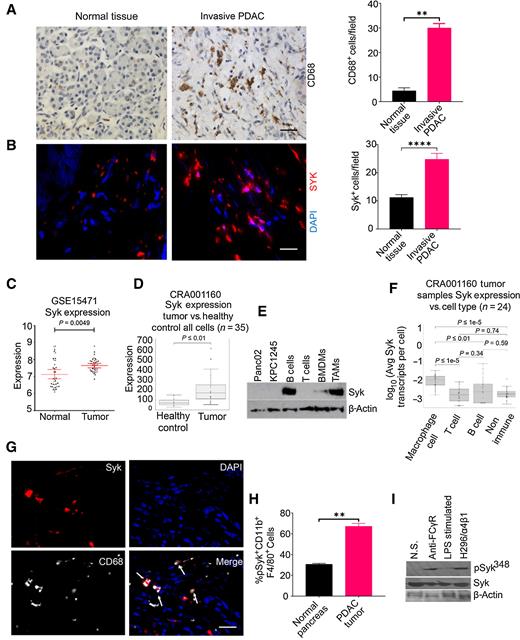 Syk Inhibition Reprograms Tumor-Associated Macrophages and Overcomes ...