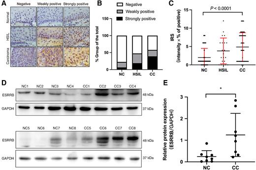 ESRRB Inhibits the TGFβ Signaling Pathway to Drive Cell Proliferation ...
