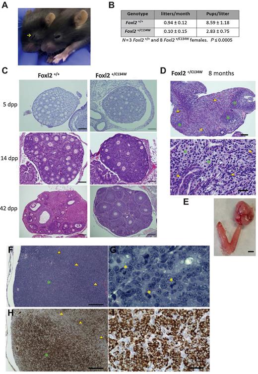 The Oncogenic FOXL2 C134W Mutation Is a Key Driver of Granulosa Cell Tumors | Cancer Research ...