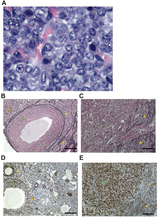 The Oncogenic FOXL2 C134W Mutation Is a Key Driver of Granulosa Cell ...