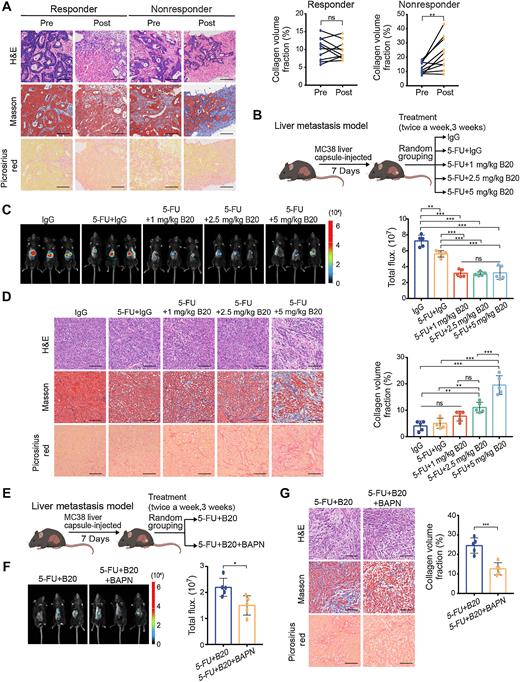 Matrix Stiffness Triggers Lipid Metabolic Cross-talk between Tumor and ...