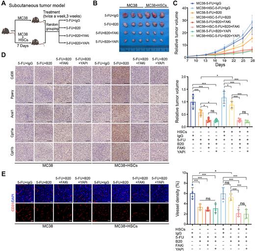 Matrix Stiffness Triggers Lipid Metabolic Cross-talk between Tumor and ...