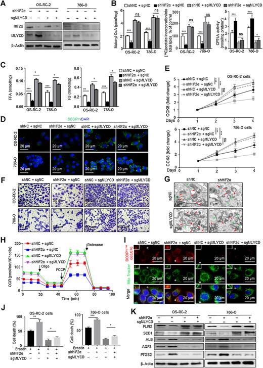 Fatty Acid Oxidation Mediated by Malonyl-CoA Decarboxylase Represses ...