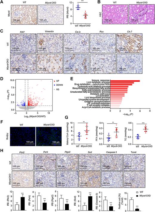 Fatty Acid Oxidation Mediated by Malonyl-CoA Decarboxylase Represses ...