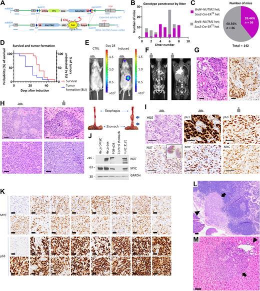 The BRD4–NUT Fusion Alone Drives Malignant Transformation of NUT ...