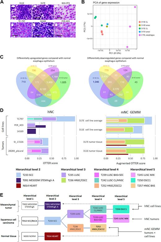 The BRD4–NUT Fusion Alone Drives Malignant Transformation of NUT ...