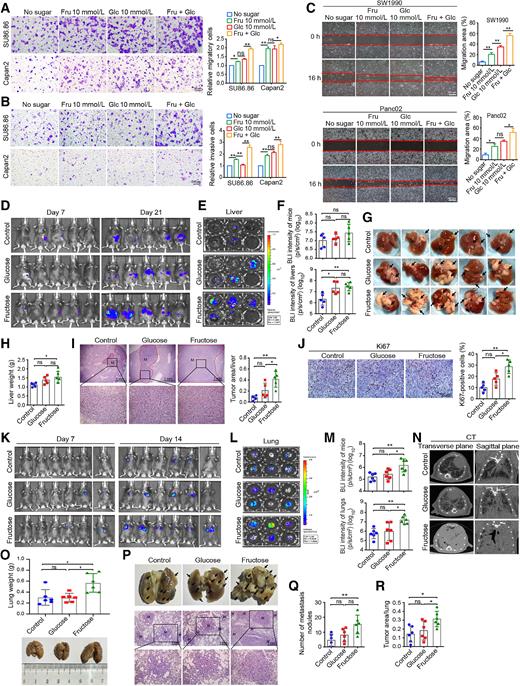 Fructose-Induced mTORC1 Activation Promotes Pancreatic Cancer ...
