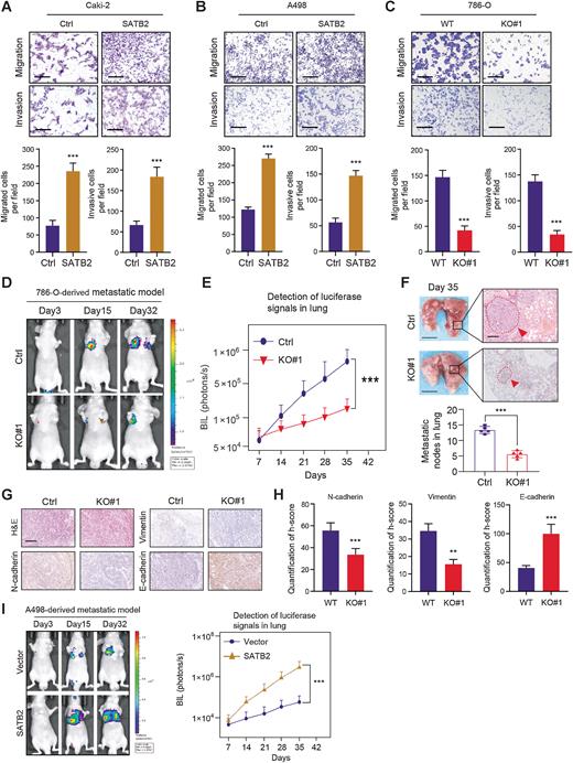 YAP-Activated SATB2 Is a Coactivator of NRF2 That Amplifies ...
